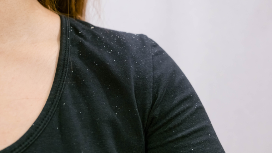 Savipuoli (Pityriasis versicolor) | Nettiterveys.fi